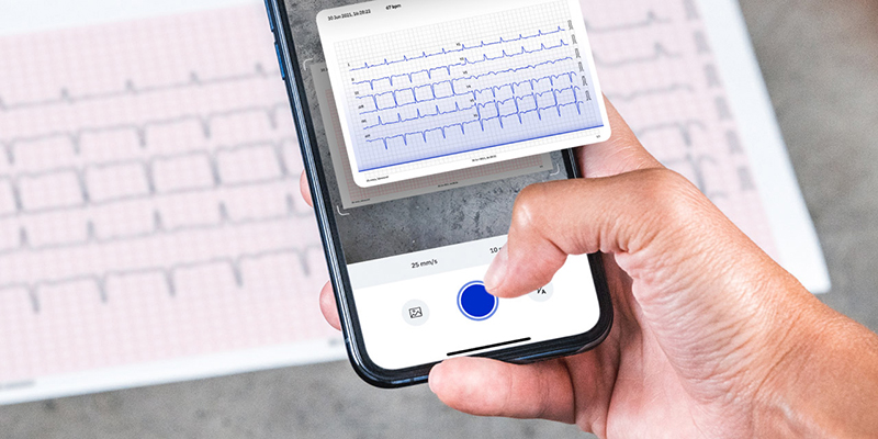 AI ecg-app voorspelt vooral aanwezigheid van atriumfibrilleren goed | H&W